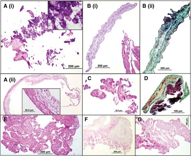 Hemacolor Set (1 & 2 & 3) – 3.004.040 – Clini Care – Κλινι Κεαρ
